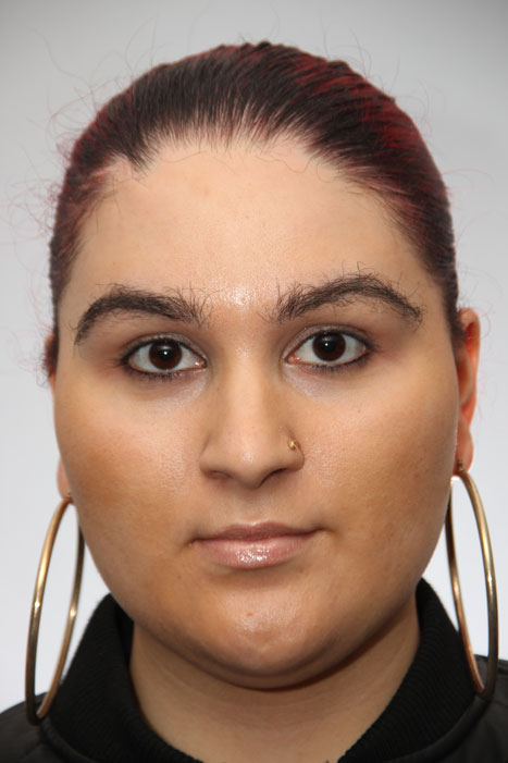 Dimple - Dr. Solomon