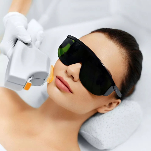 Non Surgical Fotofacial Ipl Therapy - Solomon Facial Plastic